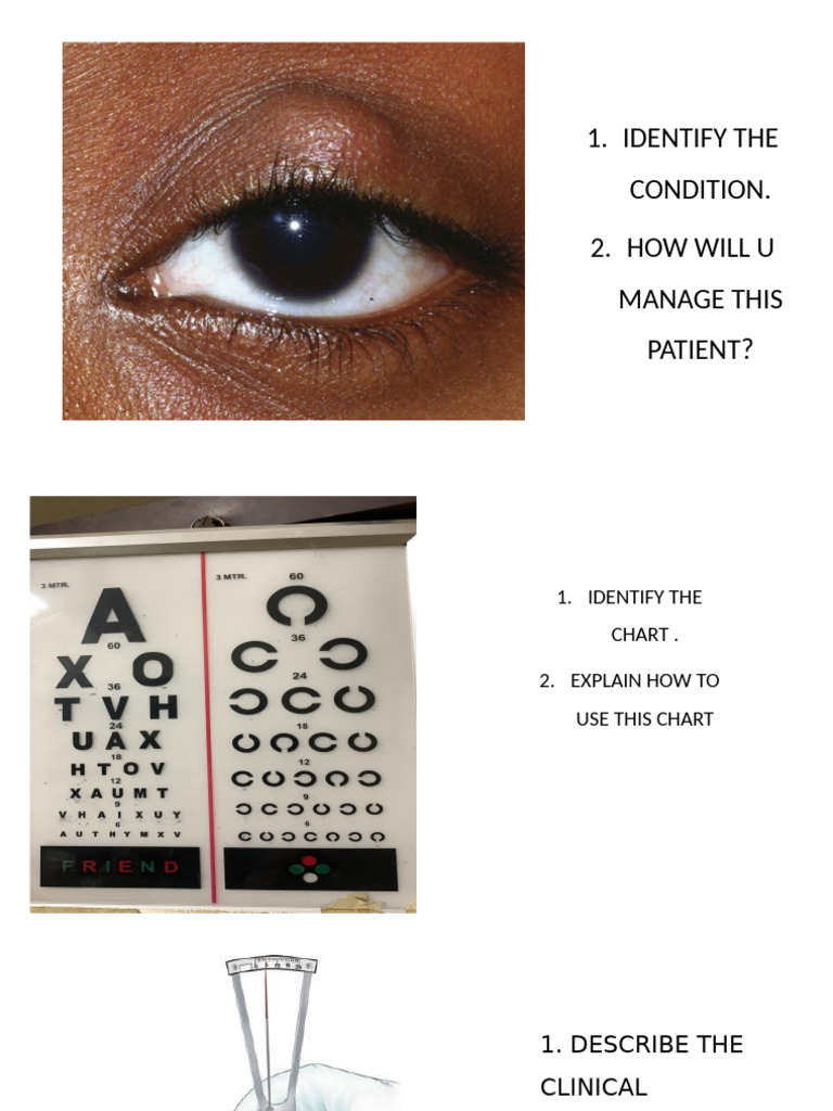 Short Case Optha | PDF
