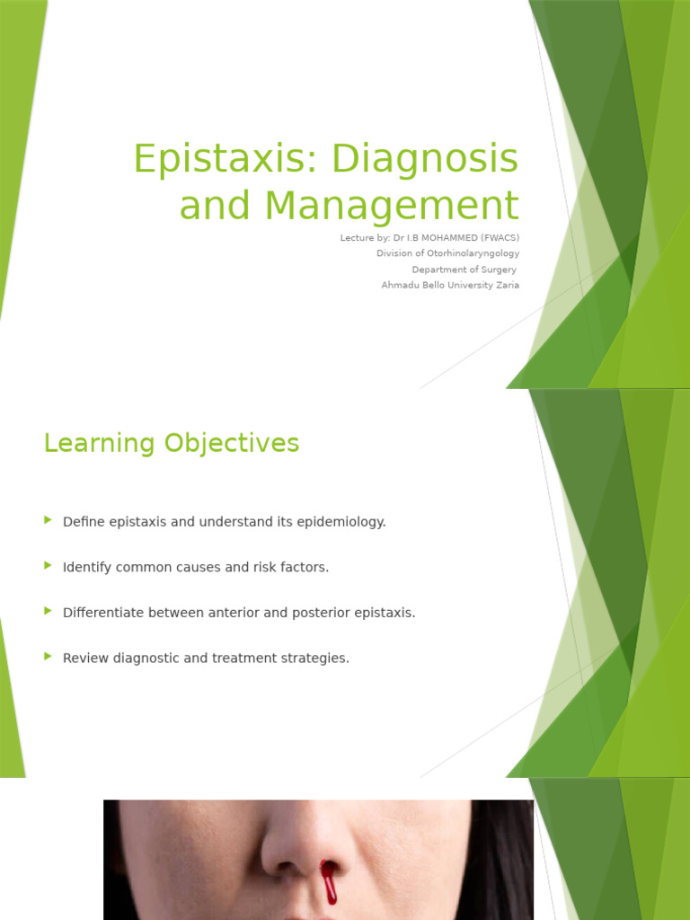 Epistaxis Diagnosis and Management Guide | PDF | Human Nose | Bleeding