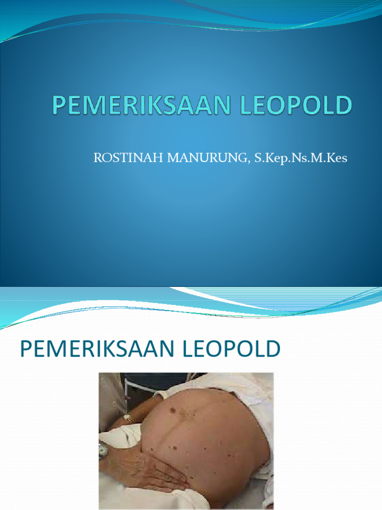 Pemeriksaan Leopold | PDF
