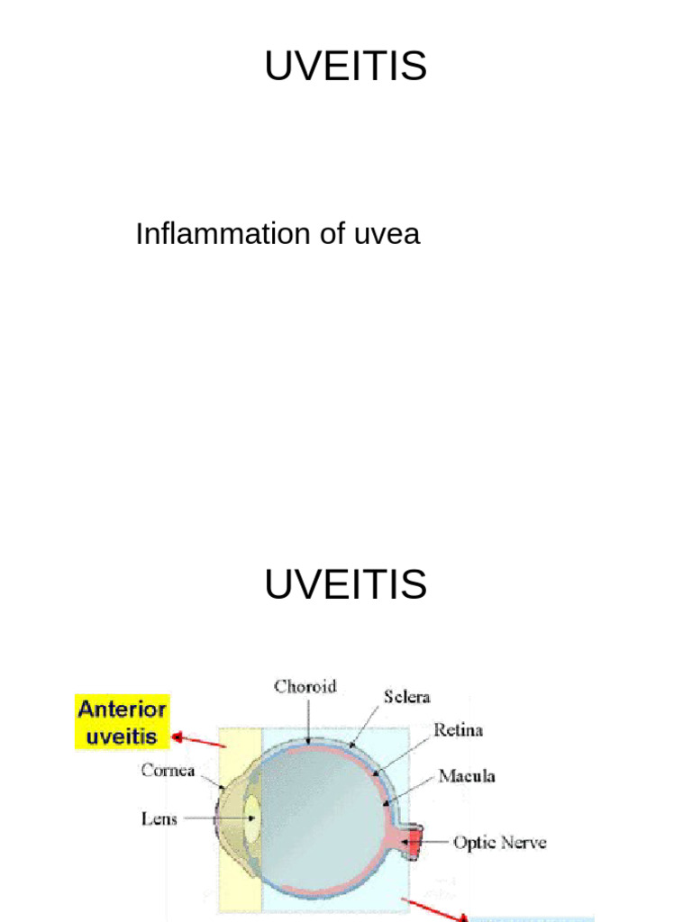 17 Uveitis | PDF | Ophthalmology | Human Eye