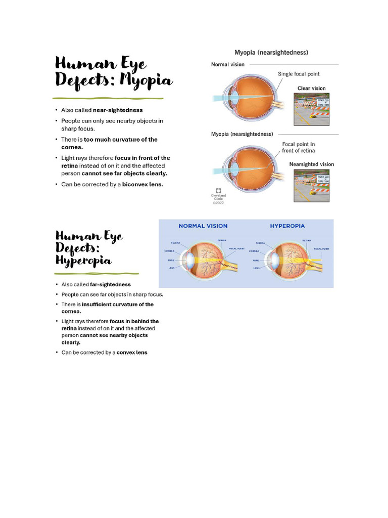 Human Eye Defects | PDF