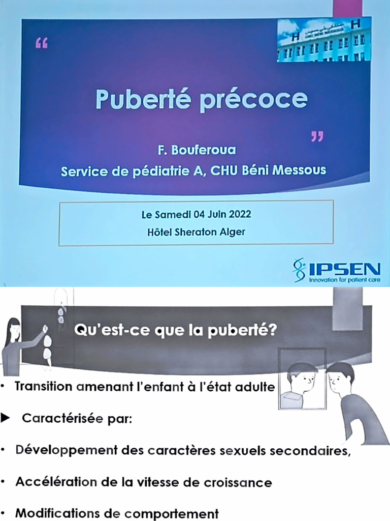 Puberté Precoce PR Bouferoua | PDF