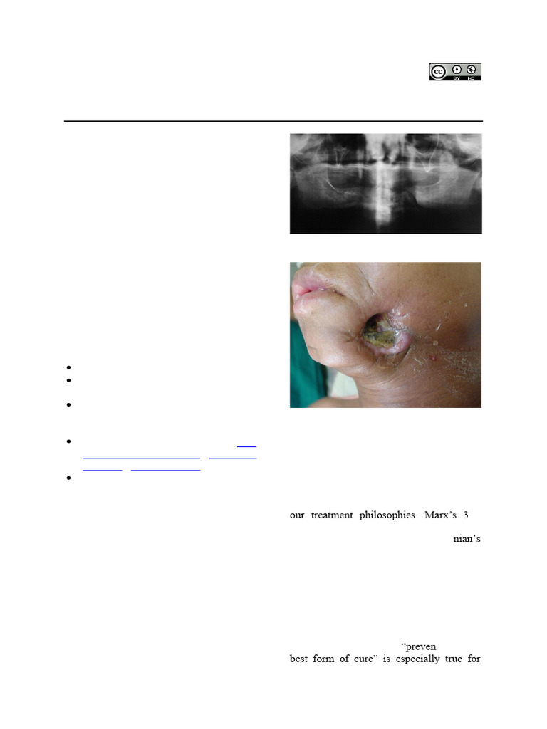Dental Extractions for Head & Neck Surgeons | PDF | Periodontology ...