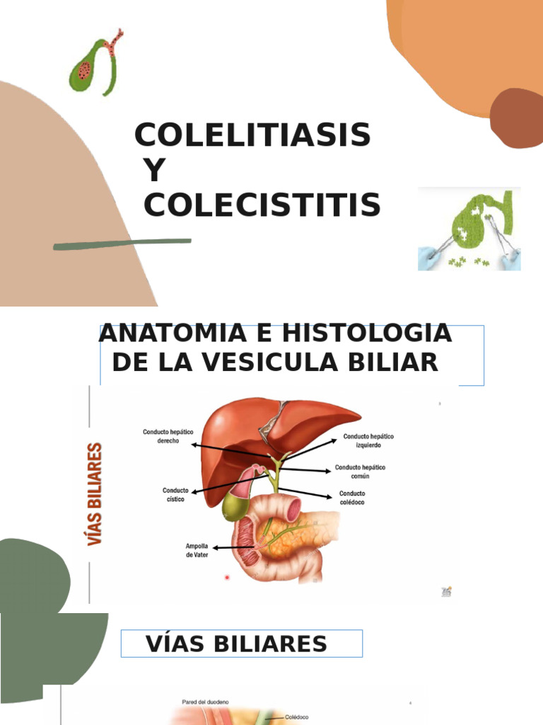 Colelitiasis y Colecistitis: Diagnóstico y Tratamiento | PDF | Vesícula ...