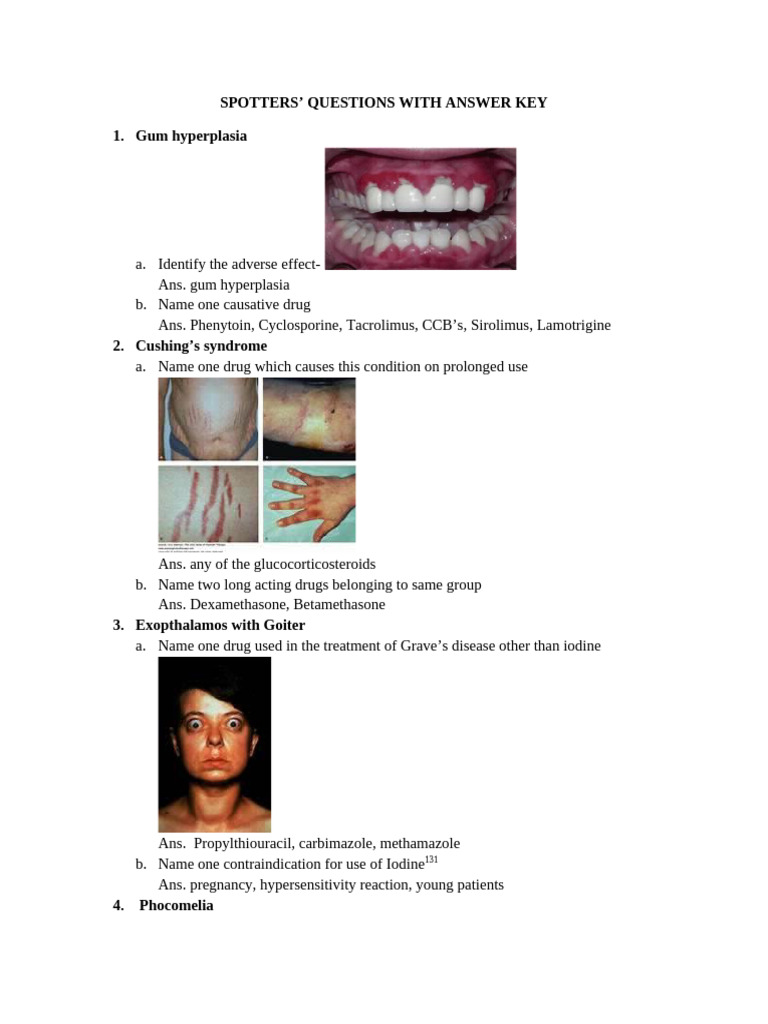 Phocomelia and Thalidomide Effects | PDF | Shock (Circulatory ...