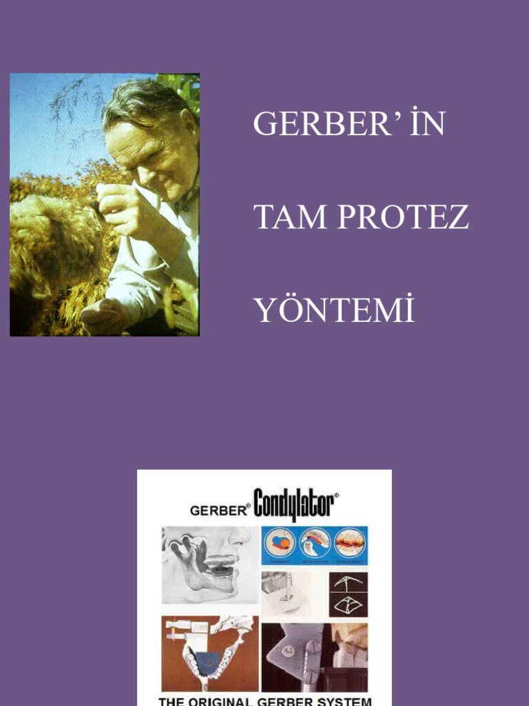 Gerber Teknikle Tam Protez Yapımı (1) Kopyası | PDF
