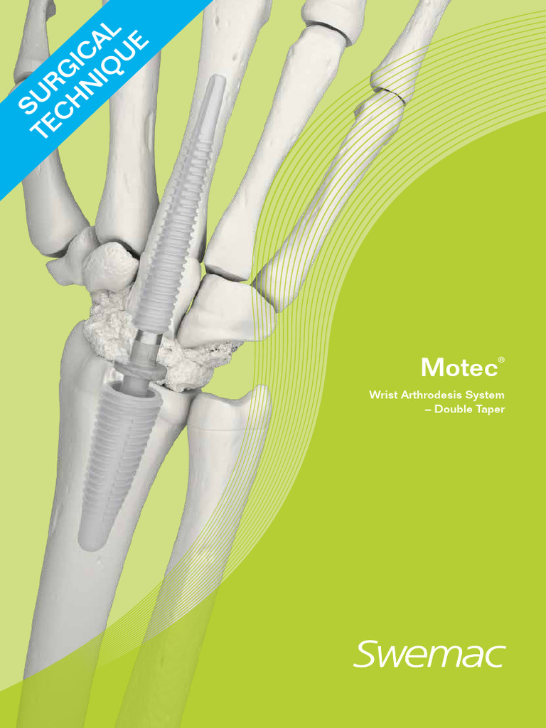 Motec Wrist Arthrodesis - Surgical Technique Double Tapers - P145!28!2 ...