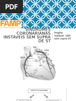 Classificacao de Killip | PDF