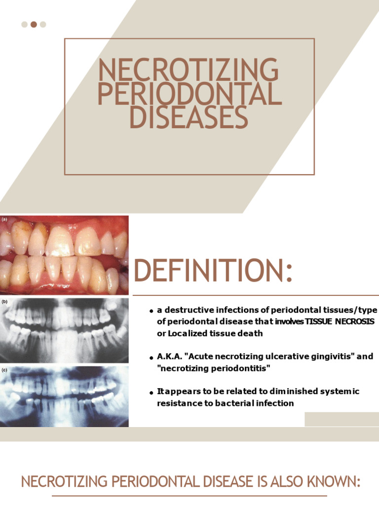 PERIO-REPORT | PDF | Periodontology | Necrosis