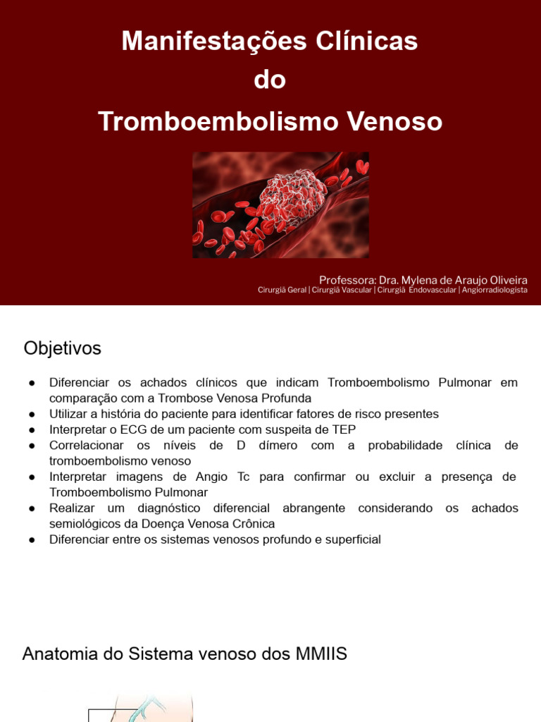TEV (TVP + TEP) + DVC | PDF | Sistema cardiovascular | Angiologia