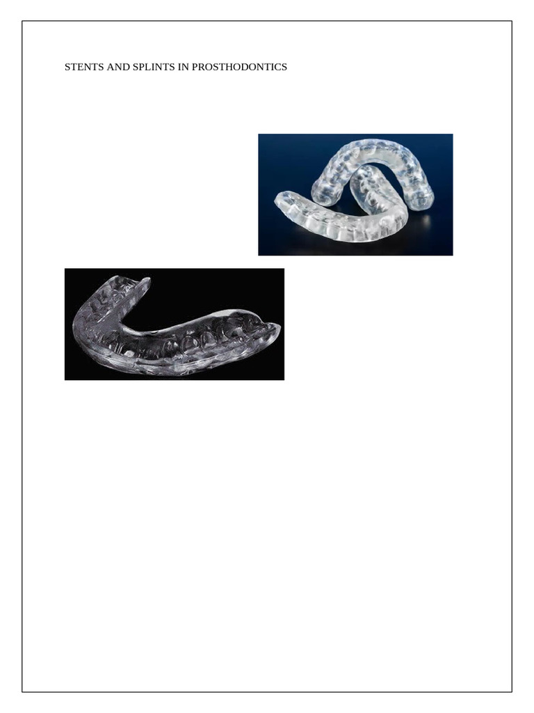 Stents and Splints in Prosthodontics | PDF | Dental Implant | Stent
