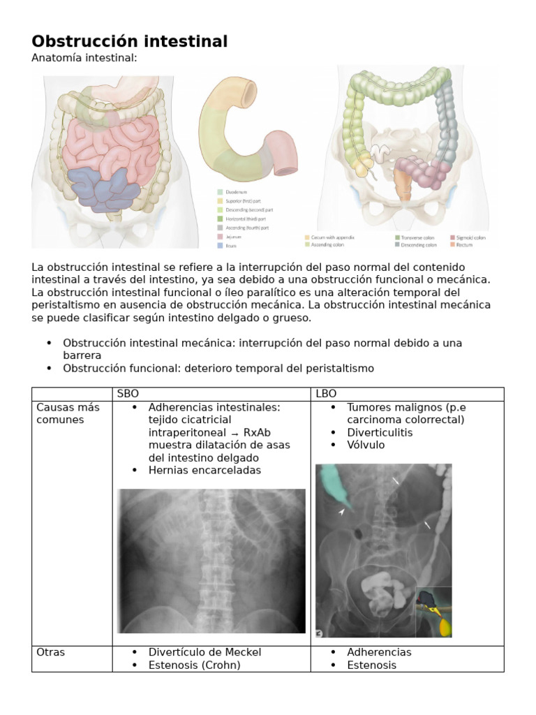 Obstrucción Intestinal | PDF | Medicina CLINICA | Enfermedades digestivas