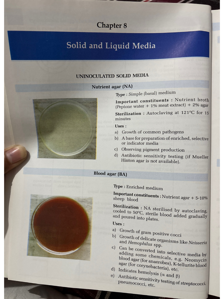 All Solid and Liquid Media Alongwith Biochemical Reactions | PDF