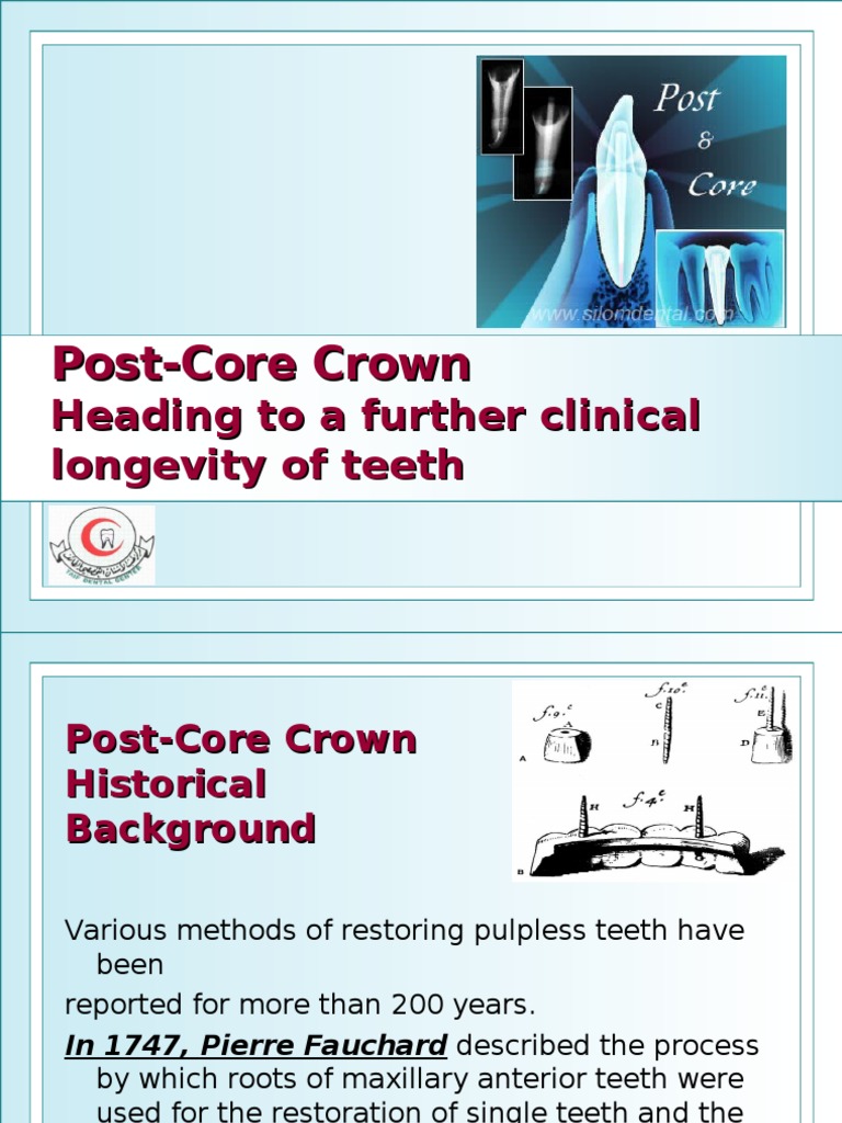 Post-Core Crown | PDF | Dentistry Branches | Health Sciences