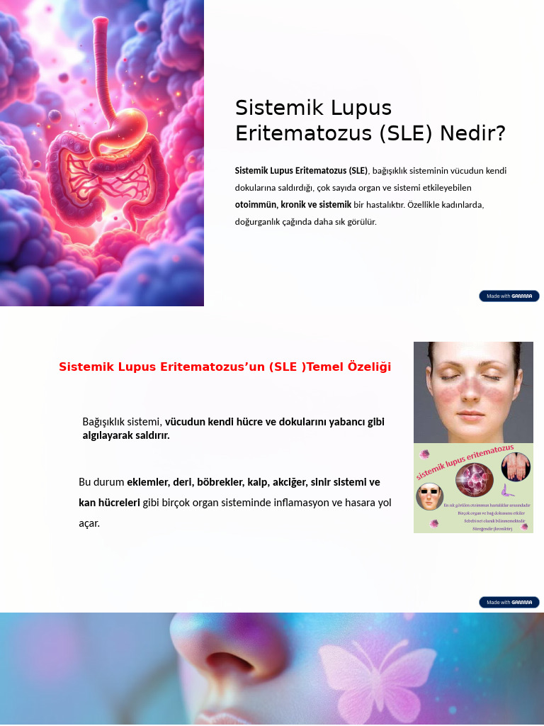 Sistemik Lupus Eritematozus SLE Nedir | PDF