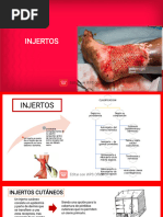 Escarotomía y Escarectomía en Quemaduras | PDF | Quemar | Herida
