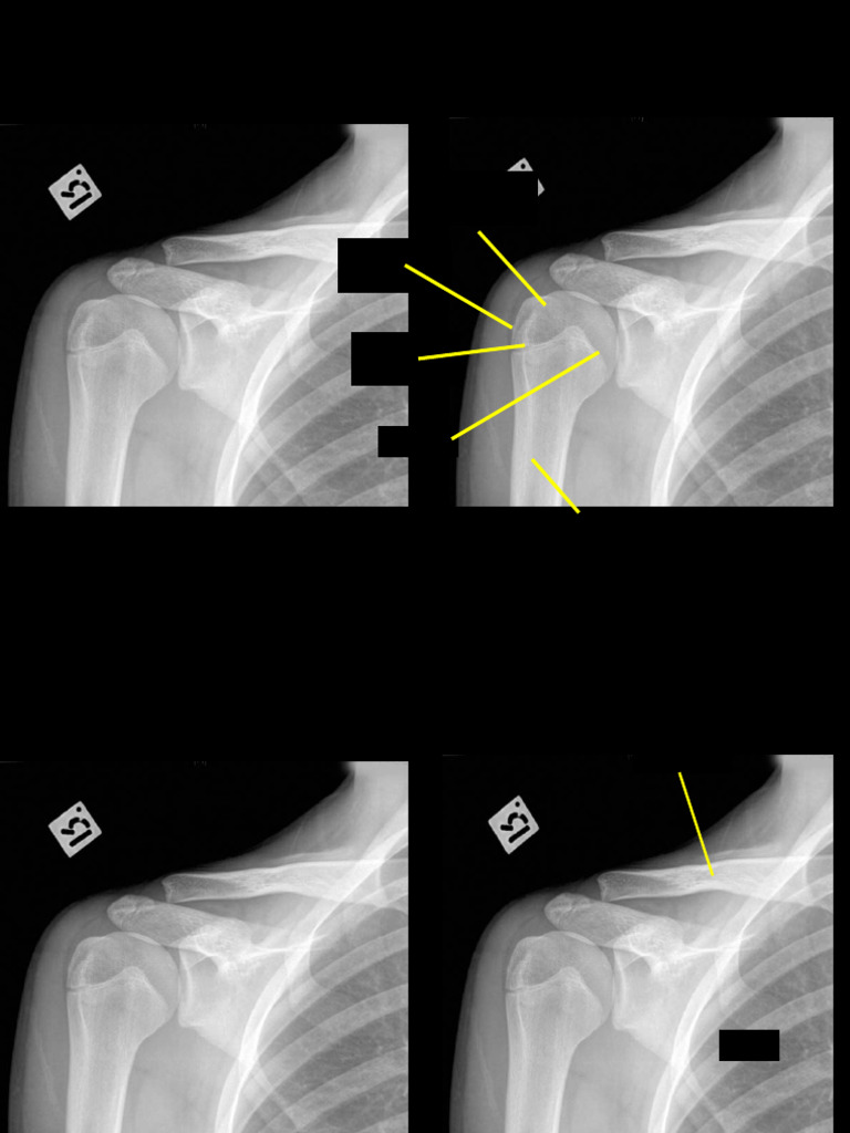 Labelled x-rays all joints | PDF | Knee | Shoulder