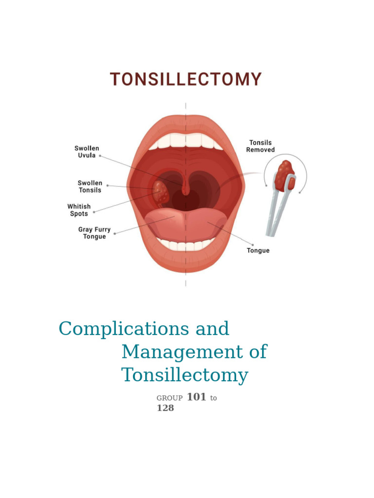 Complications and Management of Tonsillectomy.... | PDF | Bleeding ...