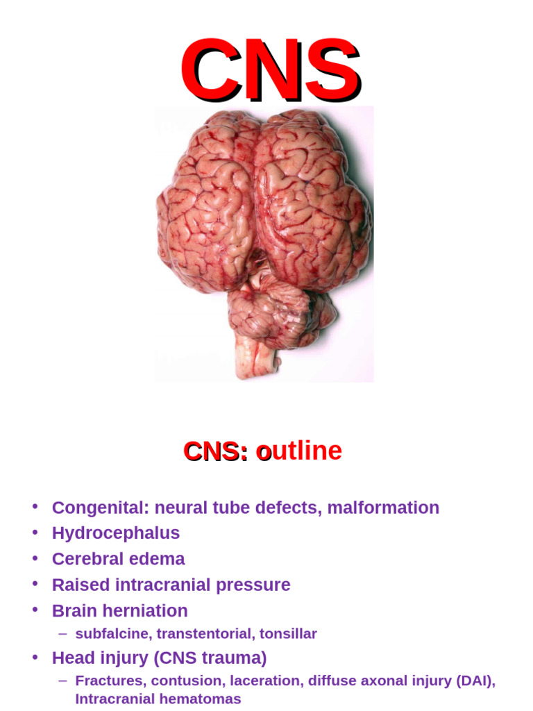 CNS Malformation, Trauma & Stroke | PDF | Cerebrospinal Fluid | Nervous ...