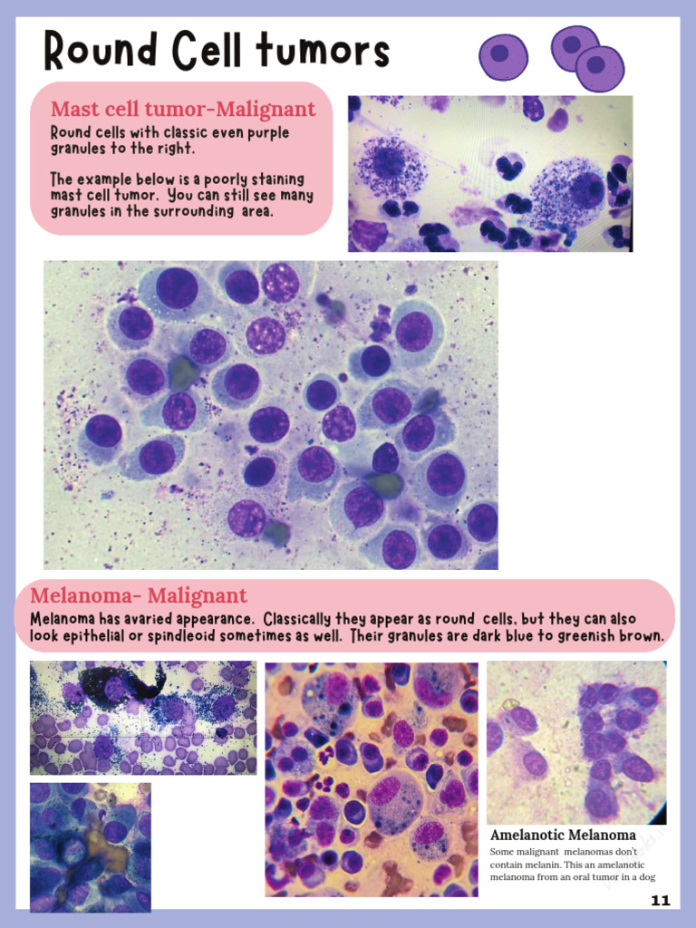 Round Cell Tumors: Mast Cell & Melanoma | PDF