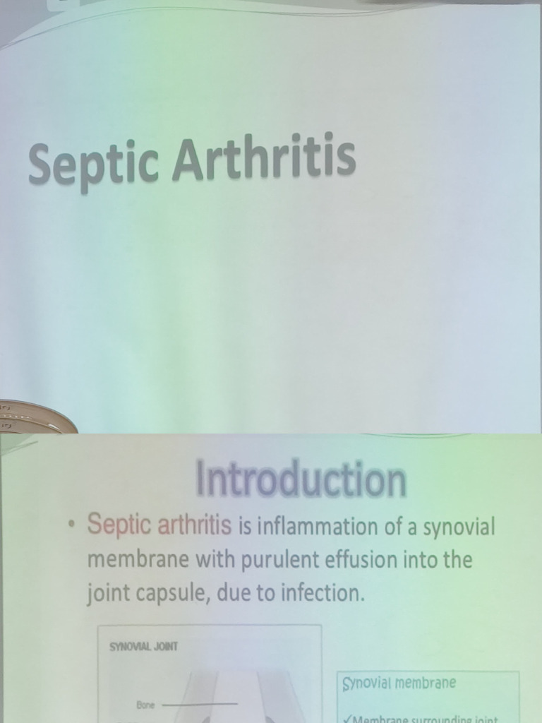 Septic Arthritis | PDF