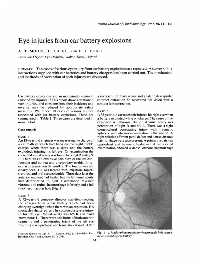 141.full Retina and Eye Diseases For Eye | PDF | Visual Acuity | Eye