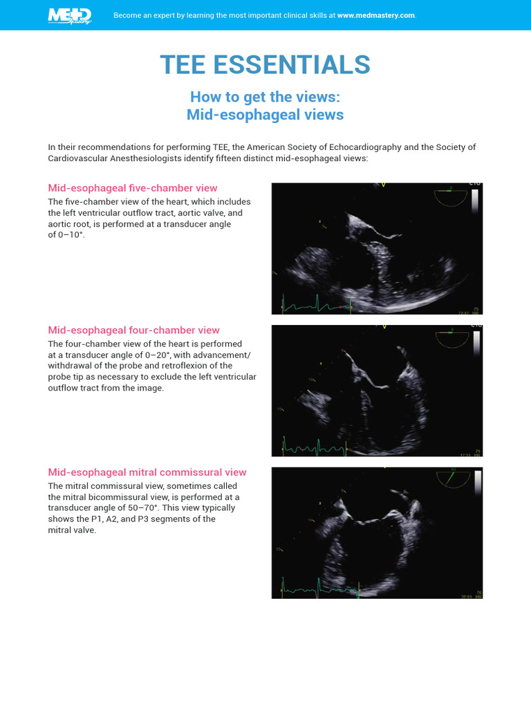 Mid-Esophageal TEE View Techniques | PDF | Heart Valve | Aorta
