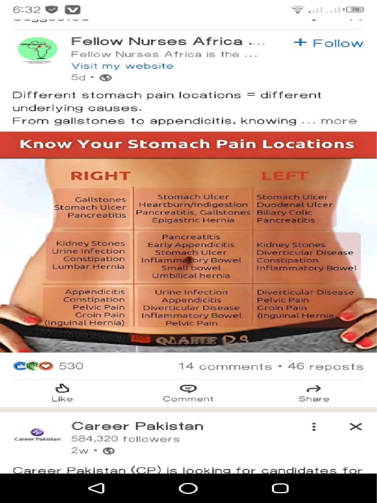 Stomach Location | PDF