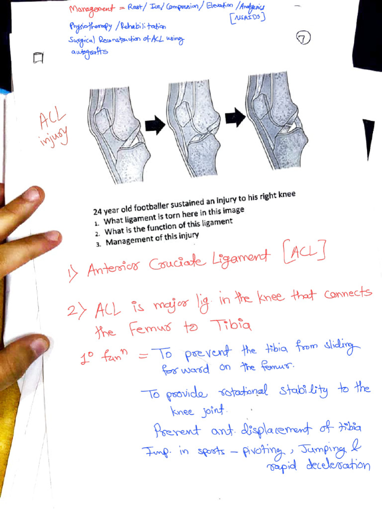 Football Injury and Fracture Management Guide | PDF