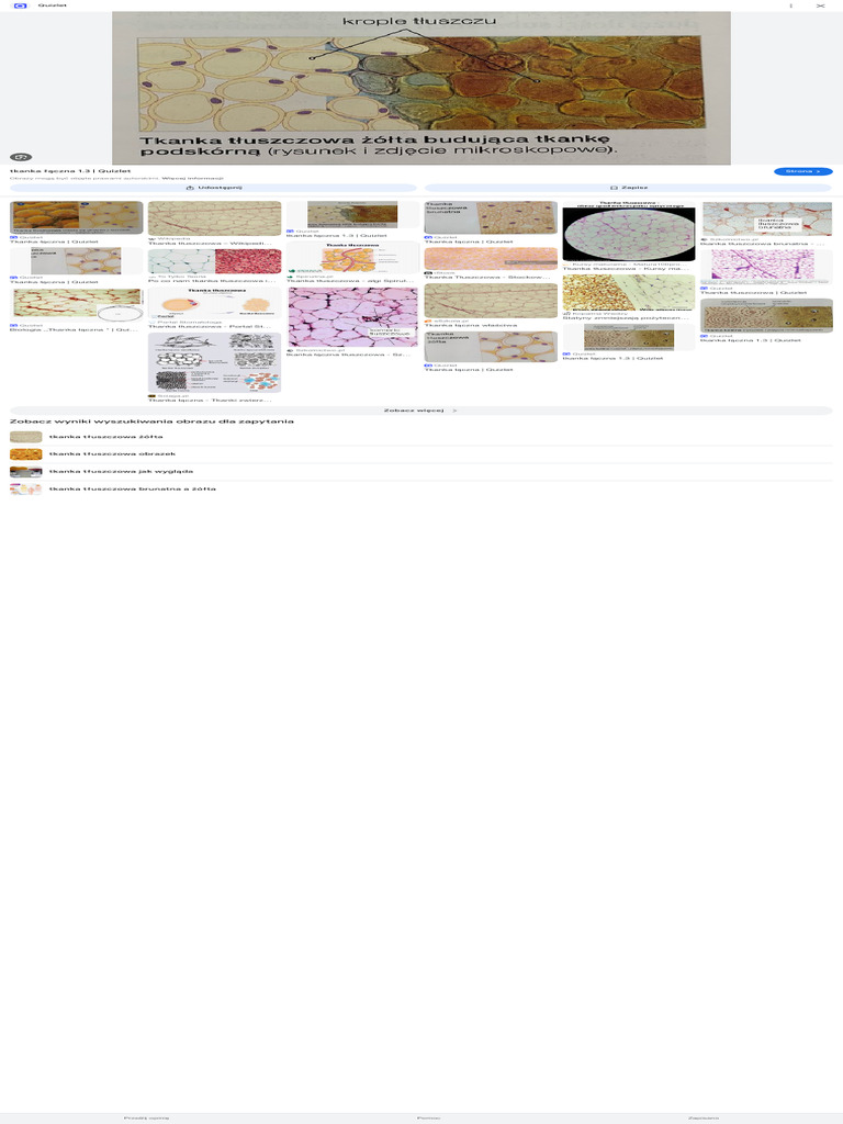 Komórki Tłuszczowe Tkanka Łączna Właściwa Tluszczowa - Szukaj W Google ...