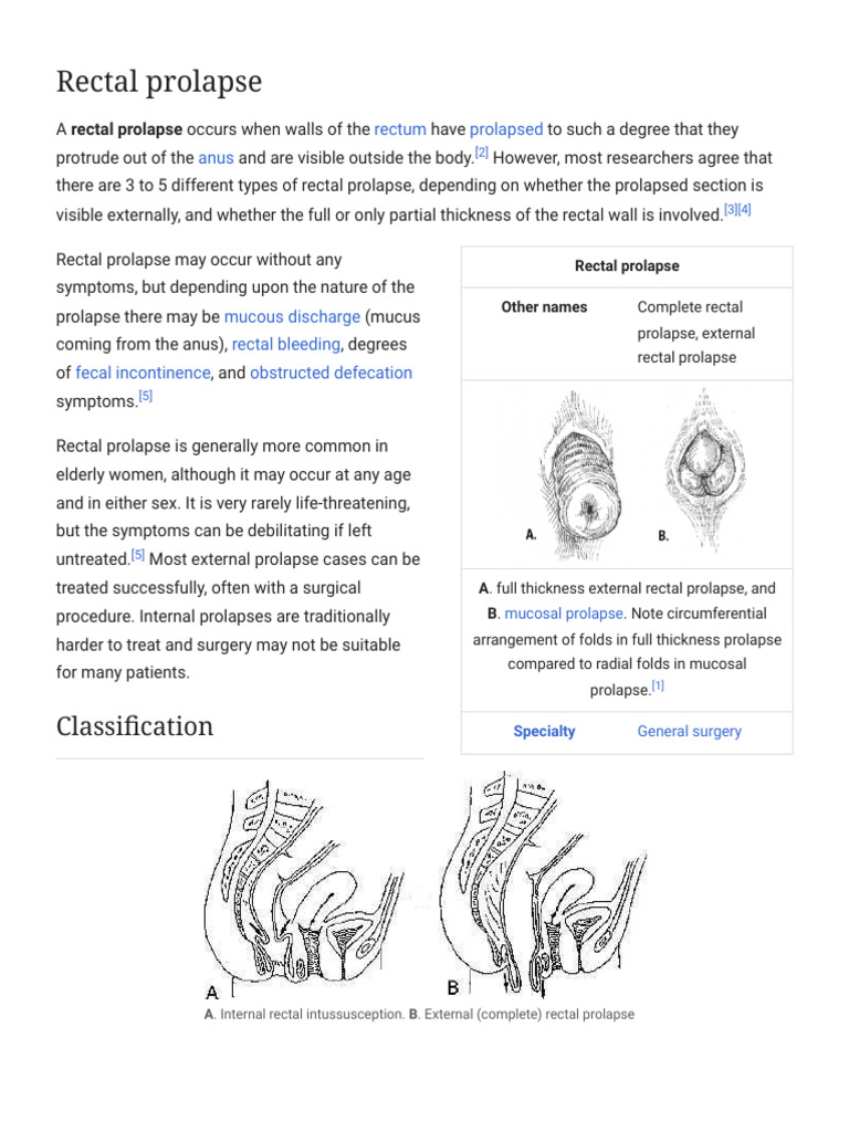 Understanding Rectal Prolapse Types | PDF | Rectum | Pelvis