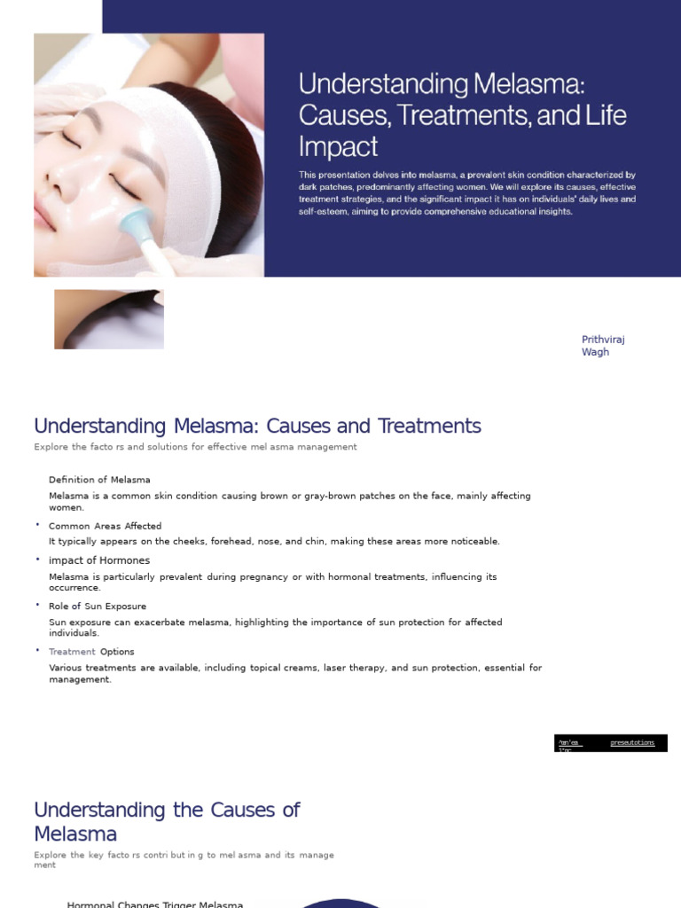 Melasma Causes, Treatments, and Educational Insights | PDF | Sunscreen ...