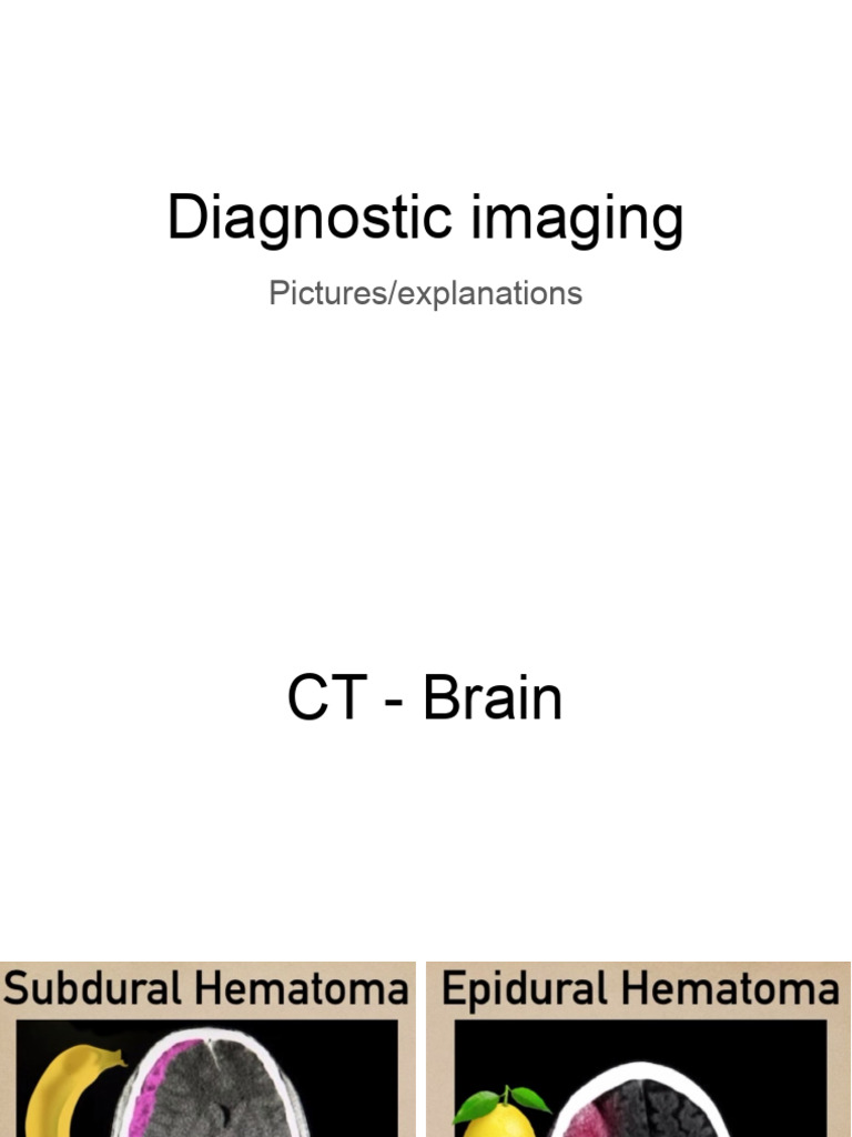 Diagnostic Imaging: Key Findings Explained | PDF | Thorax | Diseases ...