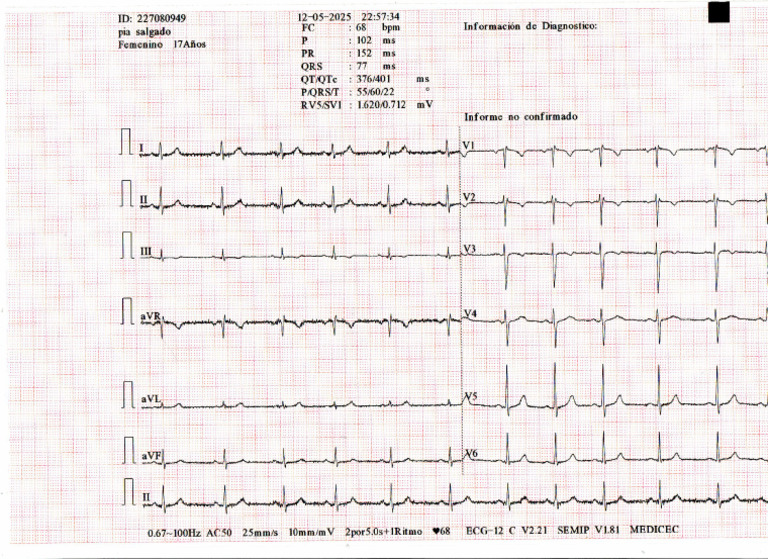 Pia Salgado - ECG | PDF