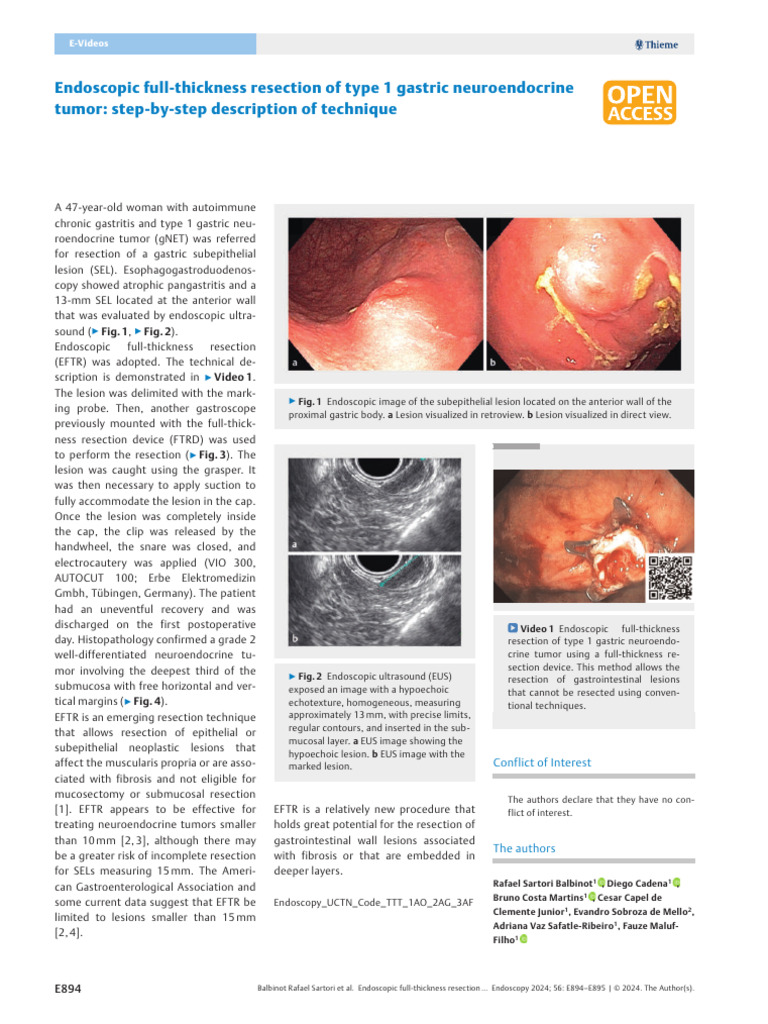 Endoscopic Full-Thickness Resection of Type 1 Gastric Neuroendocrine ...