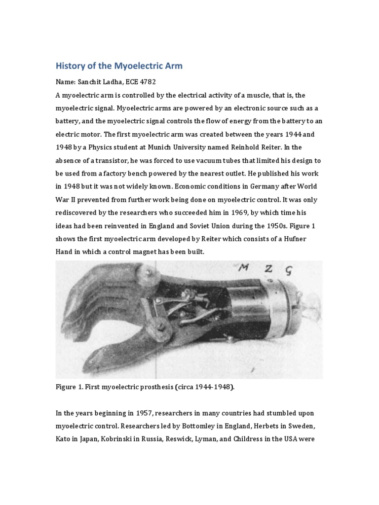 History of The Myoelectric Arm Redo | PDF | Prosthesis | Electrical ...