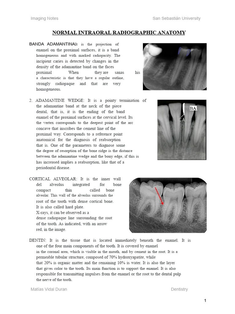 Intraoral Radiographic Anatomy Guide | PDF | Human Tooth | Human Nose