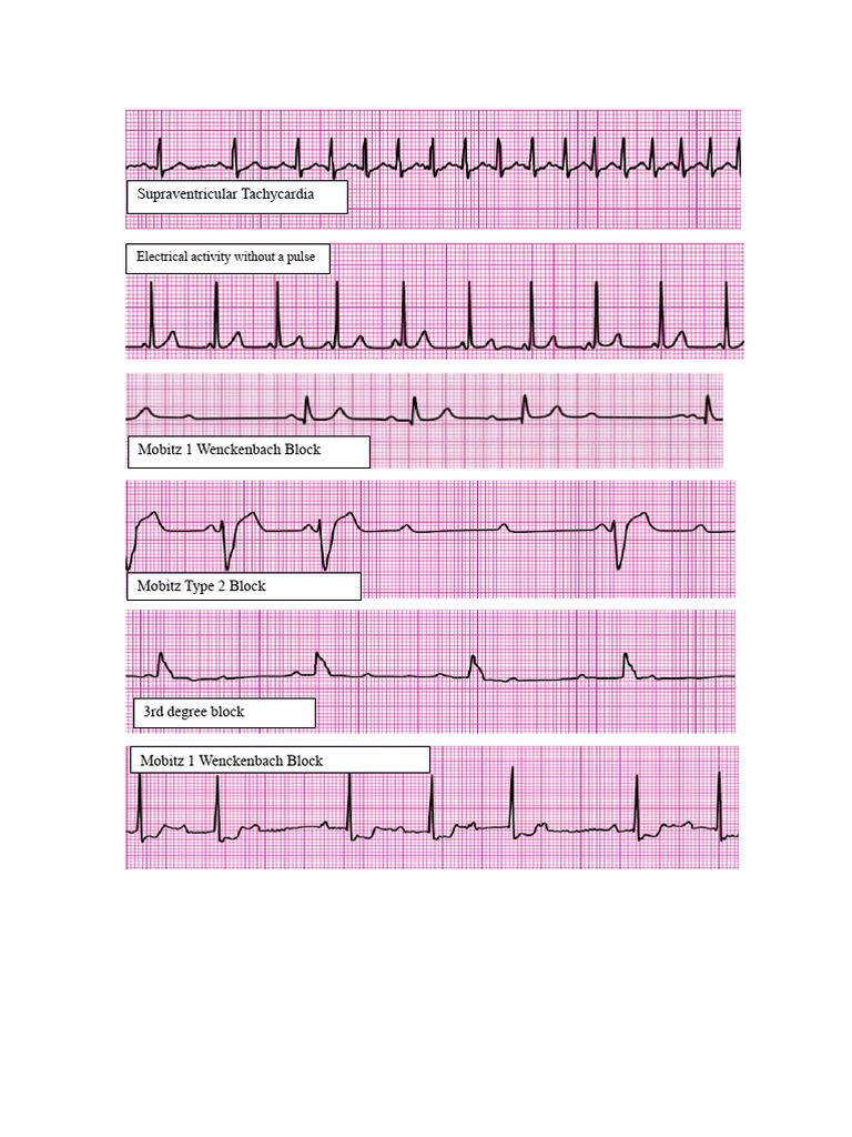 BLS ACLS | PDF | Cardiopulmonary Resuscitation | Cardiac Arrest