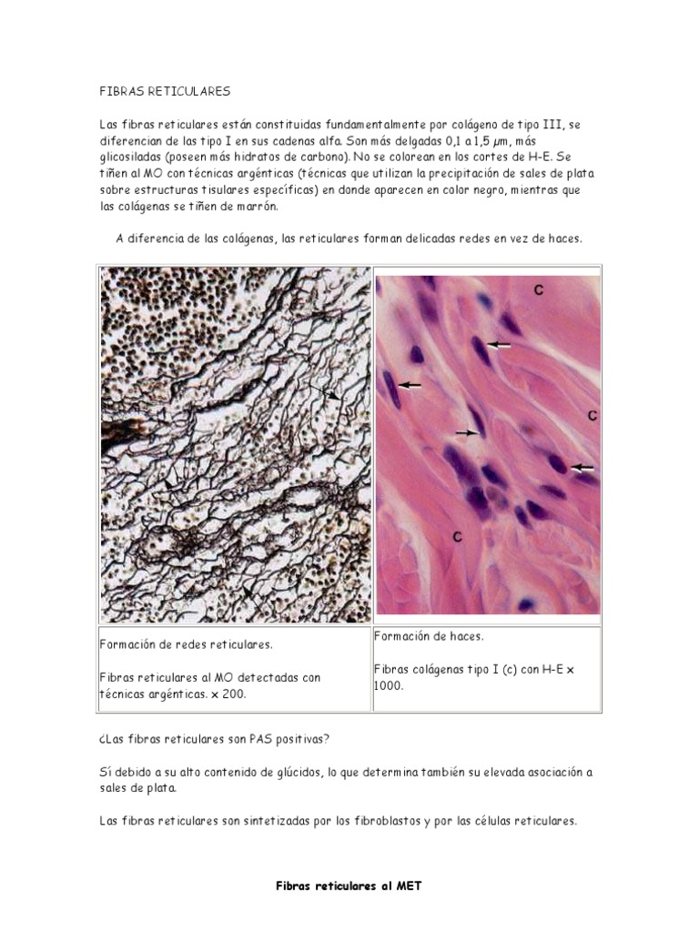 FIBRAS RETICULARES | Colágeno | Músculo