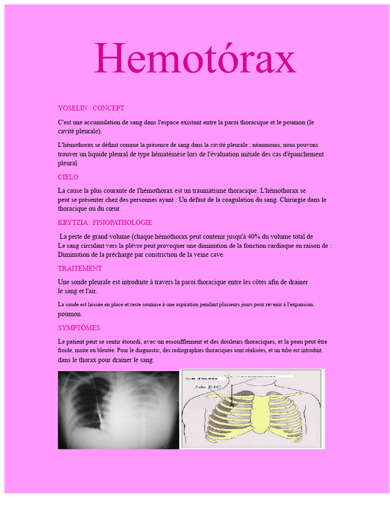 Comprendre l'hémothorax : causes et traitement | PDF