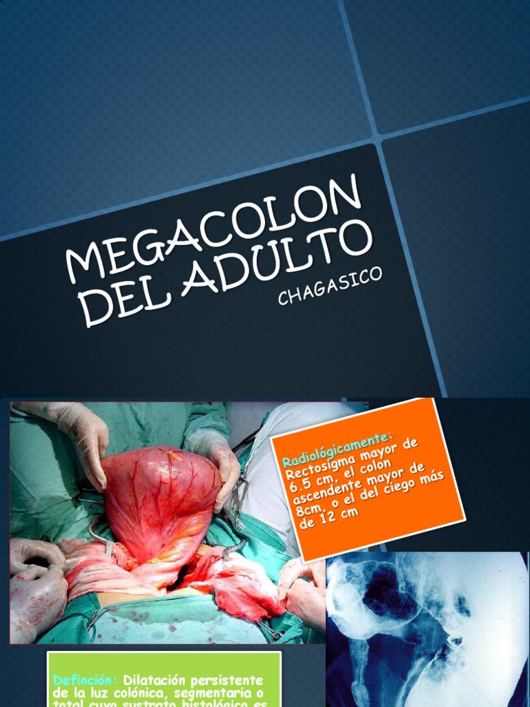 Megacolon Chagásico: Diagnóstico y Tratamiento | PDF | Intestino grueso ...