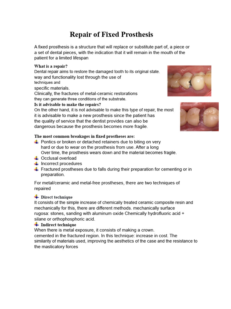 Repair of Fixed Prosthesis. | PDF | Materials | Dentistry Branches