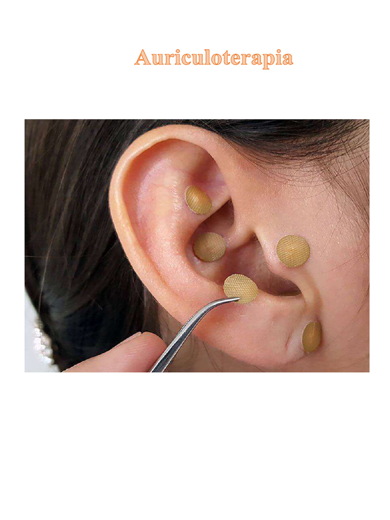 Auriculotherapy | PDF | Acupuncture | Meridian (Chinese Medicine)