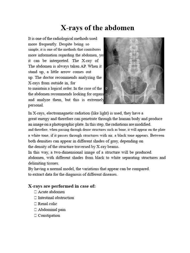 Abdominal X-ray Interpretation Guide | PDF | X Ray | Stomach