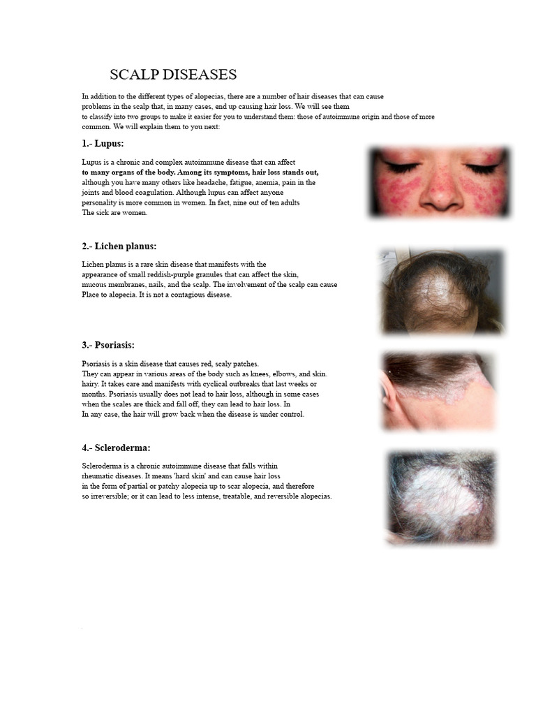 Scalp Diseases | PDF | Hair Loss | Dermatitis