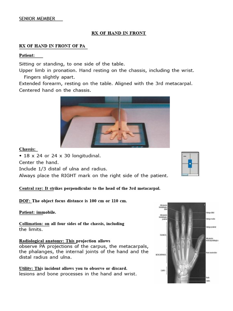 X-Ray of The Hand Frontal | PDF | Hand | Finger