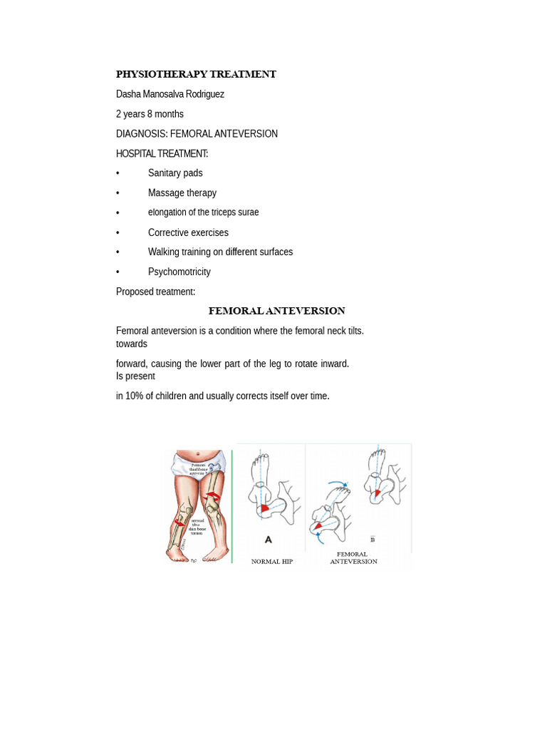 Exercises for Femoral Anteversion | PDF | Anatomical Terms Of Motion | Hip