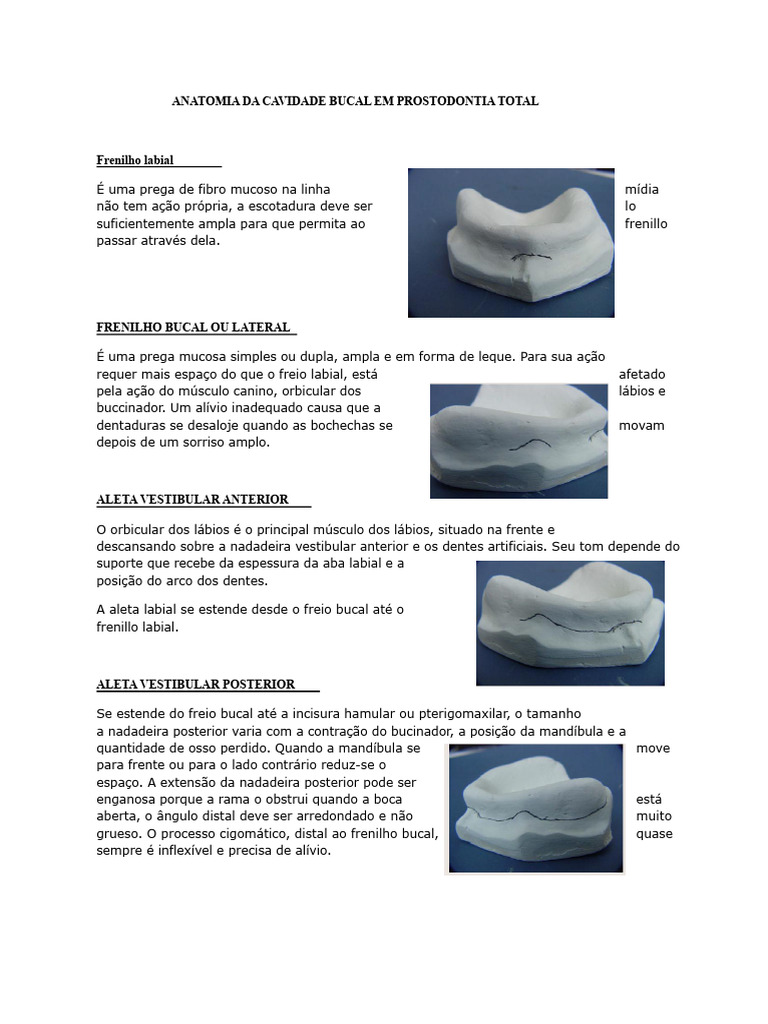 Anatomia Da Cavidade Bucal em Prostodontia Total | PDF | Boca | Anatomia