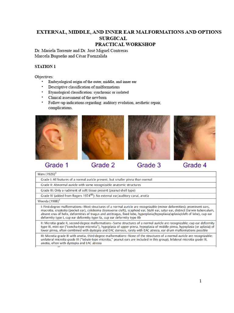 1 and 2. Malformations of The Outer, Middle, and Inner Ear and Surgical ...