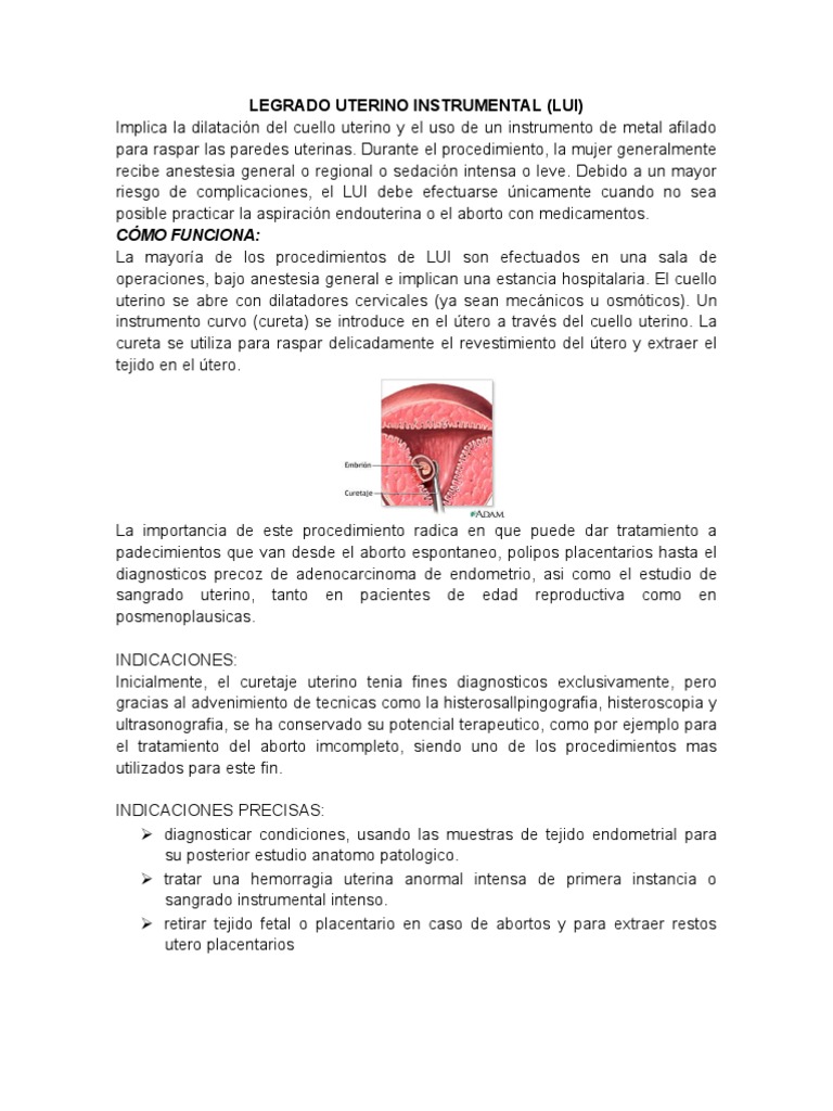 Aplicación de Forceps | PDF | Parto | Útero